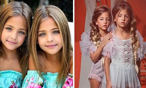 Découvrez l évolution des plus belles jumelles du monde en photo