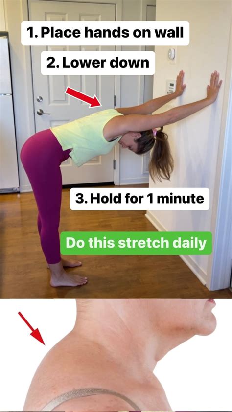 Dowagers Hump 101 7 Neck Hump Exercises That Help Artofit