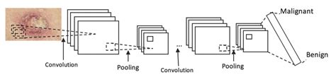 Optimization Of The Convolutional Neural Networks For Automatic