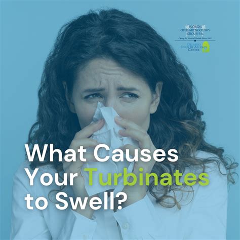👃💨 Discover The Reasons Behind Turbinate Swelling 🤔 Are You Facing