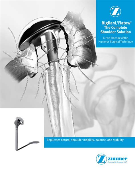 Pdf 4 Part Fracture Of The Humerus Surgical Technique · In A Three Part Fracture Fig 2 The