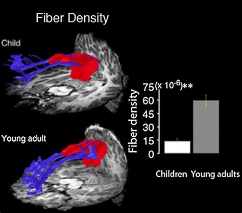 Maturation Of The Connection Between The PCC Posterior Cingulate Download Scientific Diagram