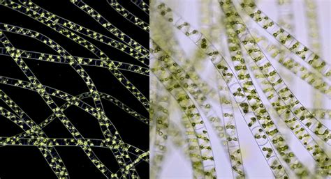 Filamentous Green Algae Microscopy Of Nature