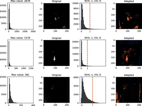 Deepsc A Deep Learning Model For Automated Diagnosis Of Primary Sclerosing Cholangitis At Two