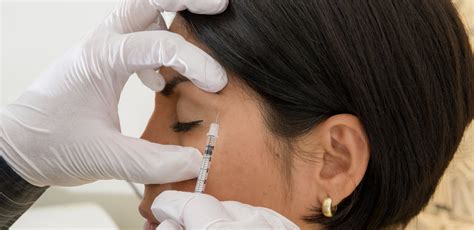 Botox For Crows Feet Dc Derm Docs