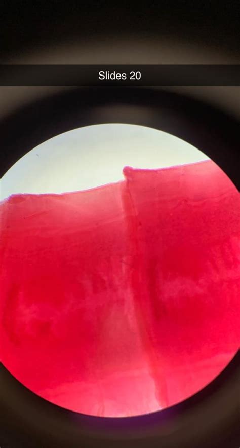 Solved In This Slide Under Microscope We Have Tapeworm
