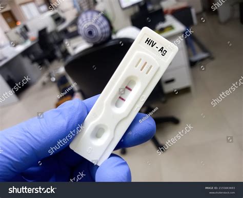 Hiv Positive Test Results