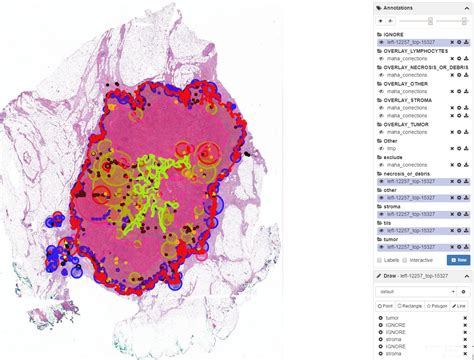 [high priority] element deletion bug · issue 719 · digitalslidearchive histomicstk · github