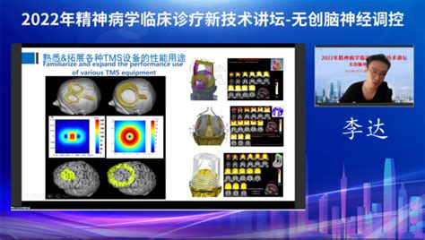 Chapter 6 Clinical Application Of Transcranial Magnetic Diagnosis And Treatment Technology In