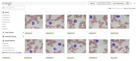 Kili Technology On Linkedin Product Batch Classification