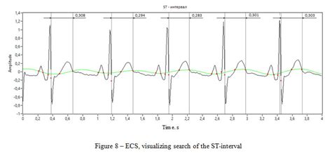 Algorithm Of St Interval Selection At Daily Monitoring To Assess
