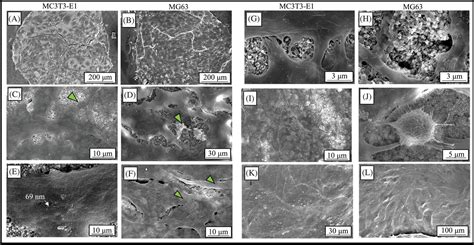 Microfluidic Device With A Carbonate Rich Hydroxyapatite Micro Coating