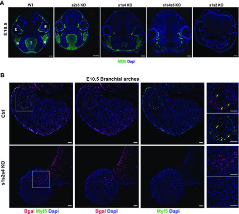 Six1 And Six2 S Requirement For Craniofacial Myogenesis A