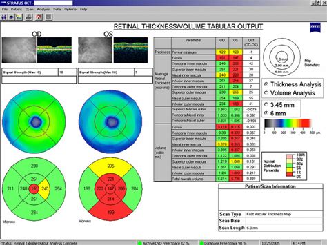An Oct Report For The Macular Region Of The Retina From The Same Download Scientific Diagram