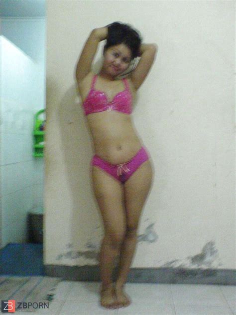 Dewi Yasa Congenital Female From Lombok Zb Porn