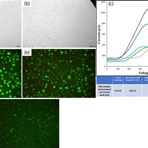 Further Analyses By Hif1‐α Ihc Marker On Some Samples Which Cdp Has
