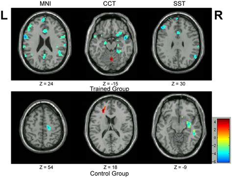 Whole Brain Correlation Maps Of The Sfn And Bold Contrast Download