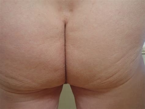 Cock And Arse 15 Pics Xhamster