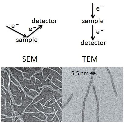 Transmission Electron Microscope Vs Scanning Electron Microscope