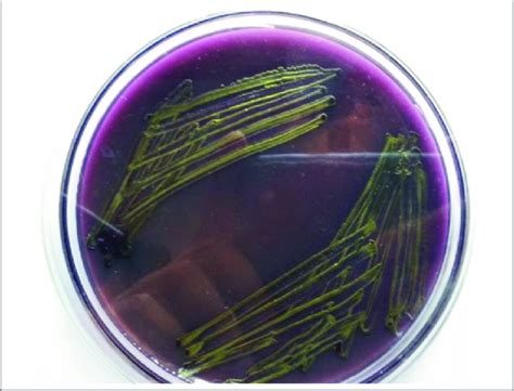 Greenish Metallic Sheen On Emb Agar Download Scientific Diagram