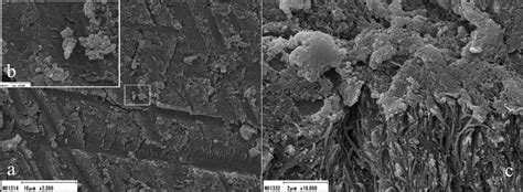 Representative Sem Micrograms Of Dentin Smear Layers Dentin Surface