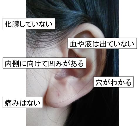 ピアスの穴が安定しない原因は何？対処法も合わせて解説