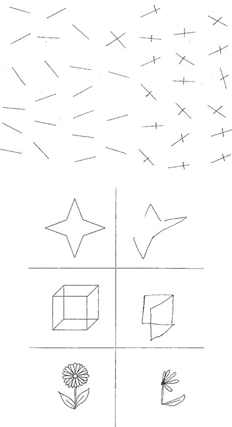 Performance Of A Patient With Spatial Neglect In Two Subtests Of The Download Scientific