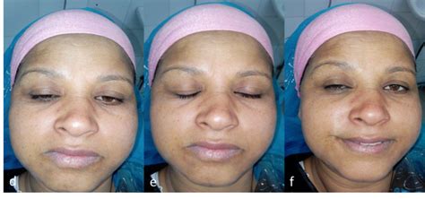 Facial Tics In Adults Job Porn