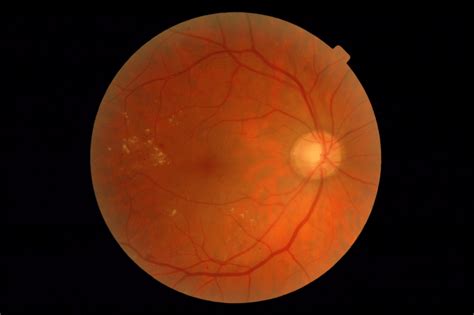 How Can I Segment Entire Objects From Original Image Given A Segmented Image Containing Pixels