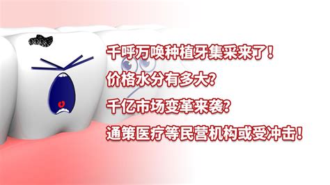 千呼万唤种植牙集采来了价格水分有多大千亿市场变革来袭 全球财说 商业新知