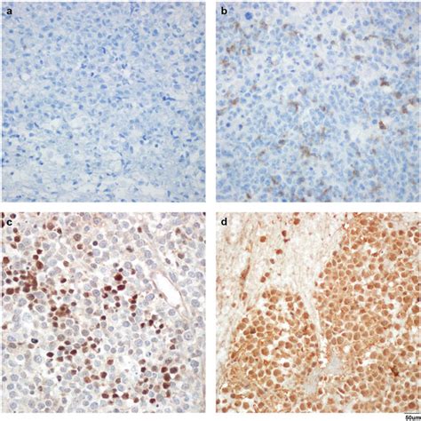 Representative Immunohistochemical Stains In Formalin Fixed And