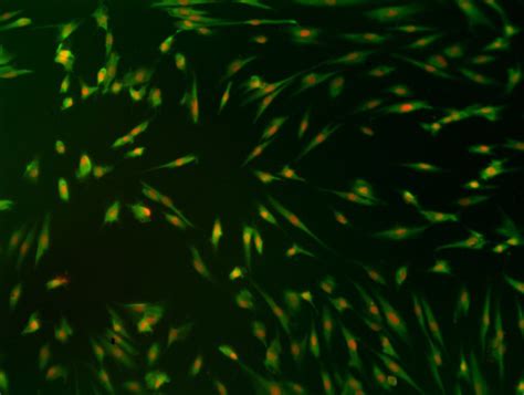 Vimentin Expression In Cultured Human Dermal Fibroblasts Vimentin