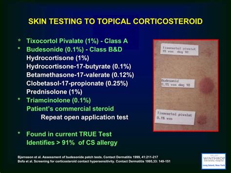 Contact Dermitis Dermatitis Contact Allergens Ppt