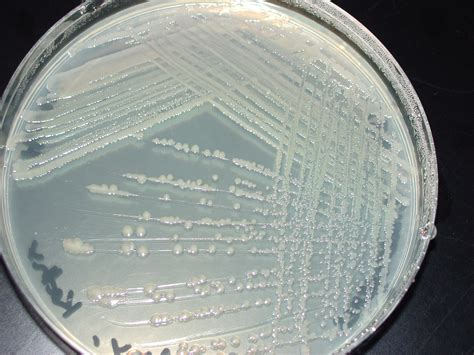 Plate Of Enterobacter Aerogenes Thats Been Streaked For Isolation