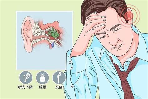耳鸣≠肾虚 知乎