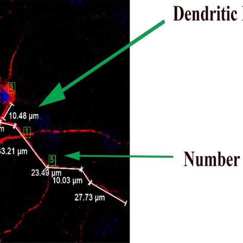 Illustrations Of Primary Neuron Culture And Data Analysis Approaches
