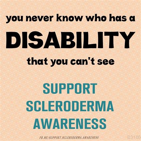 Help End Scleroderma † What Is Scleroderma Scleroderma Is A Rare
