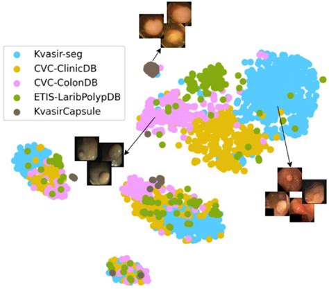 Applied Sciences Free Full Text Polyp Generalization Via