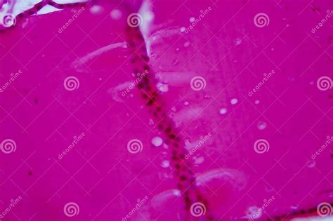 Thyroid Gland Under A Microscope Light Micrograph Exhibiting Typical