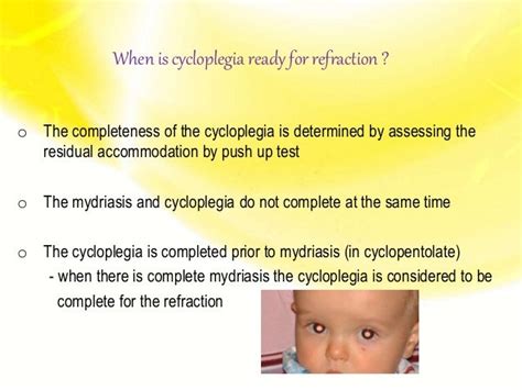Retinoscopy Principle And Techniques Of Retinoscopy