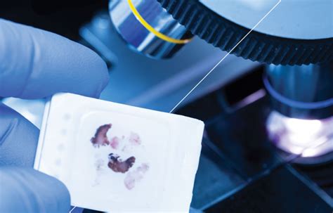 Custom Tissue Microarrays Tmas Precision For Medicine