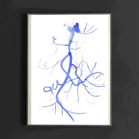 Radiology Art Dsa Internal Iliac Artery Uterine Artery Medpapers