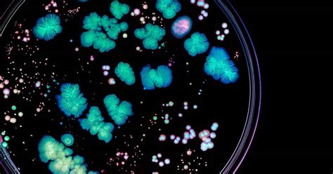 Total Viable Count Tvc Test Cts Water Microbiology