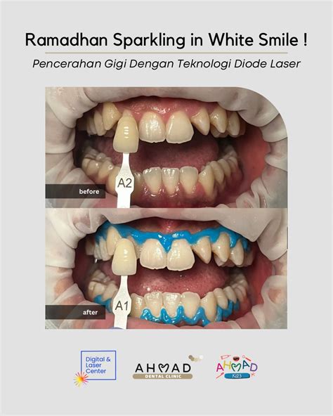 Ahmad Dental Clinic Id • Instagram Photos And Videos