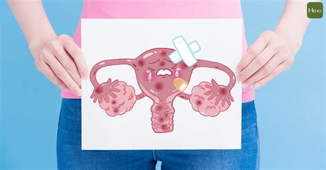 經痛要人命！到底是「子宮肌瘤」還是「子宮腺肌症」？一表看懂兩者差異 Heho健康
