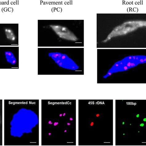 3d Segmentation Of Nuclei And Chromocentres Using The Nucleusj Plugin