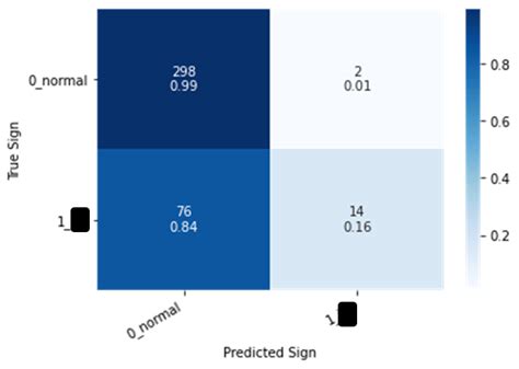 Focal Loss Performs Worse Than Cross Entropy Loss In Clasification