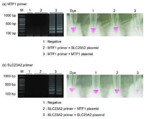 Results Showing The Agarose Gel Electrophoresis And Color Detection Download Scientific Diagram