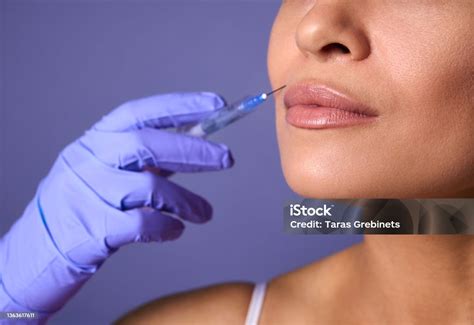 주사 미용학 미적 수술 입술 확대 및 교정 개념 그녀의 입술 근처에 주사기를 들고 수술 장갑에 여성의 얼굴과 손의 클로즈업 뷰티 트리트먼트를받을 준비가 보톨리눔 독소 주사에