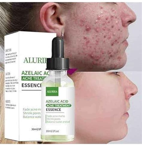 ګرم بازار Garam Bazar د مخ د دانو لپاره بهترین سیروم